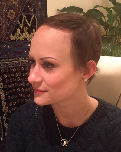 Hair Replacement - Lucinda Ellery Inc. Los Angeles - Adw LA HR 1v2